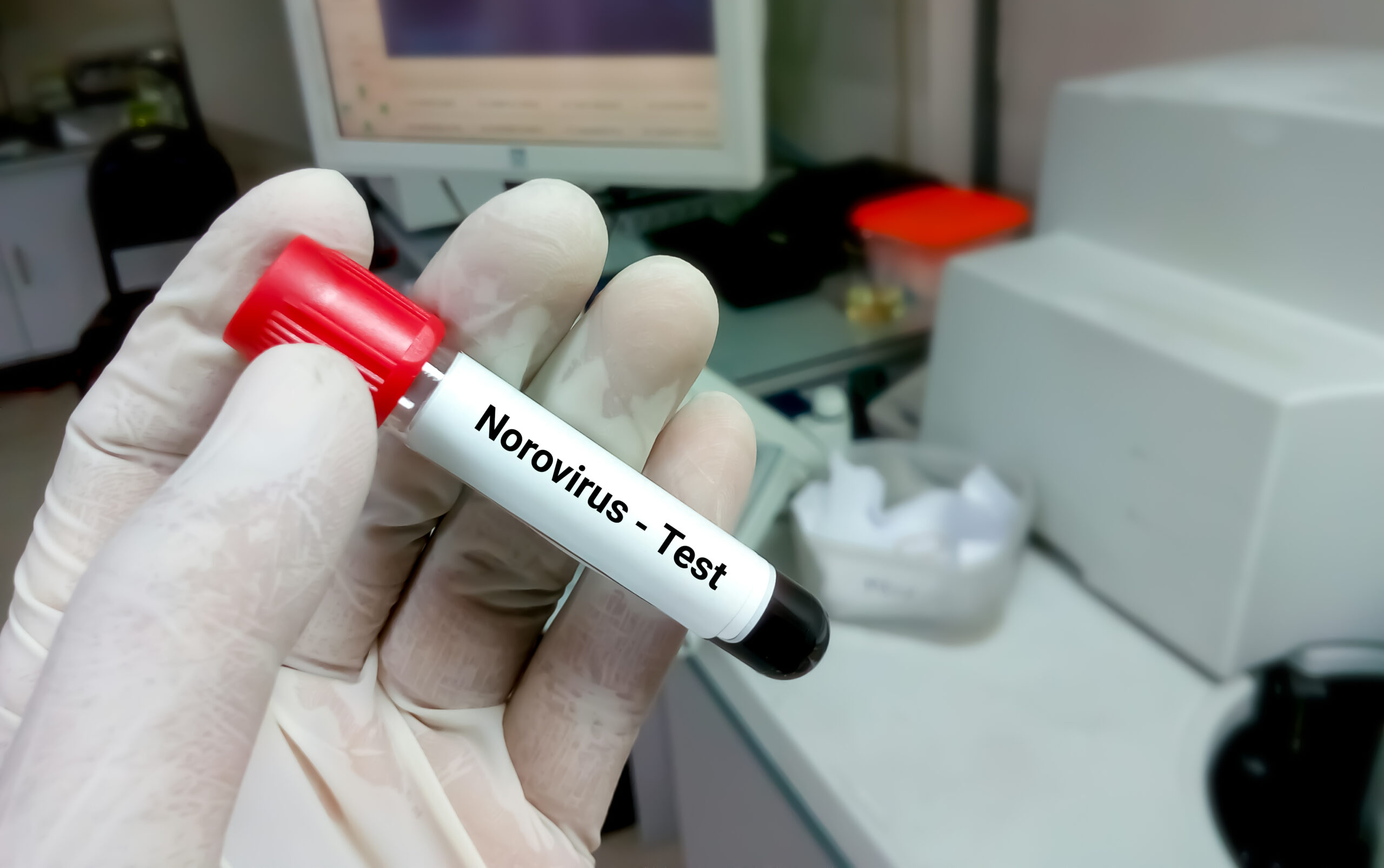 scientist-hold-blood-sample-tube-for-norovirus-test - Welliecare