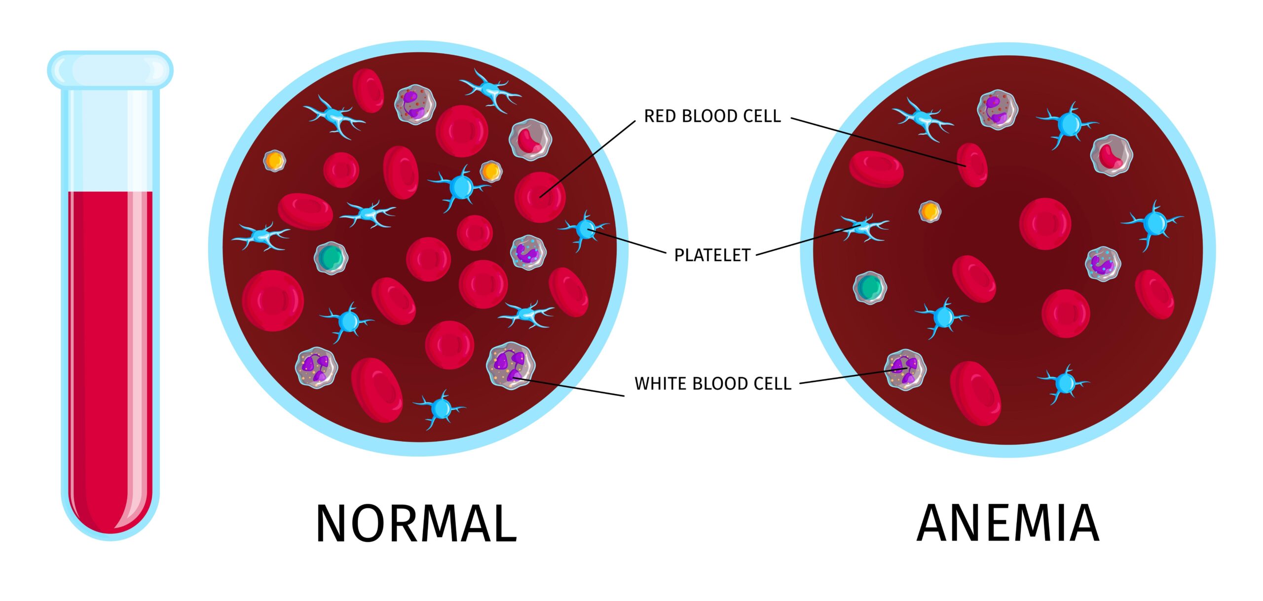 difference-sang-normal-vs-sang-anemie - Welliecare