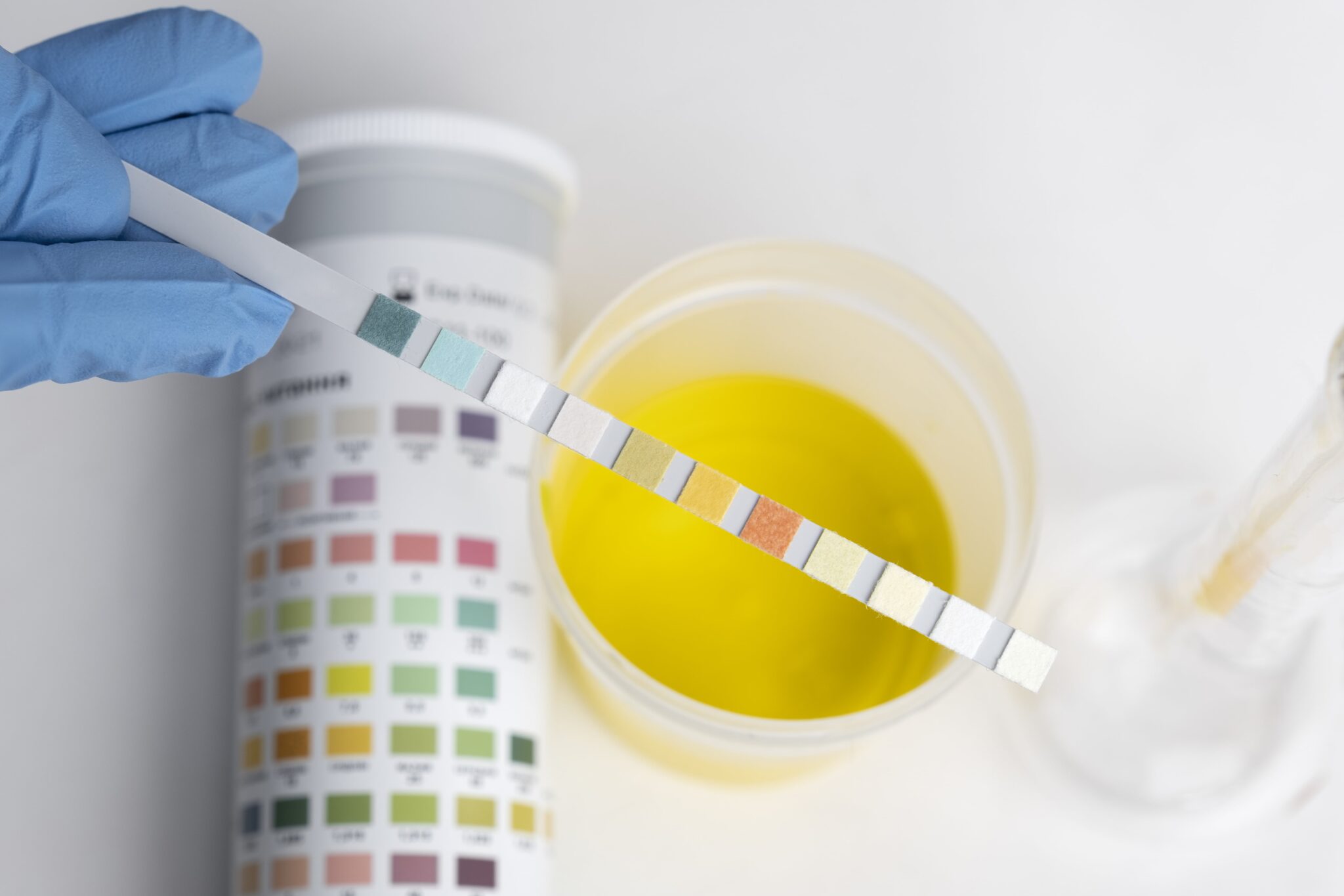L'urine détaillée : son fonctionnement et ses aspects