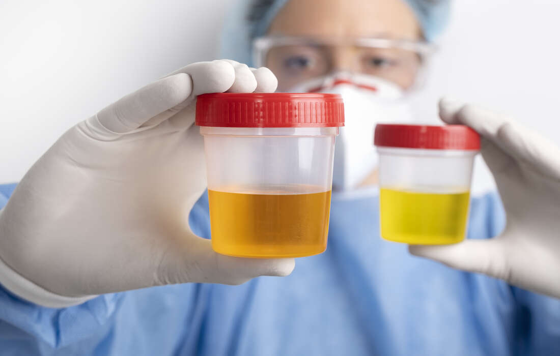 Tests Urinaires - Welliecare