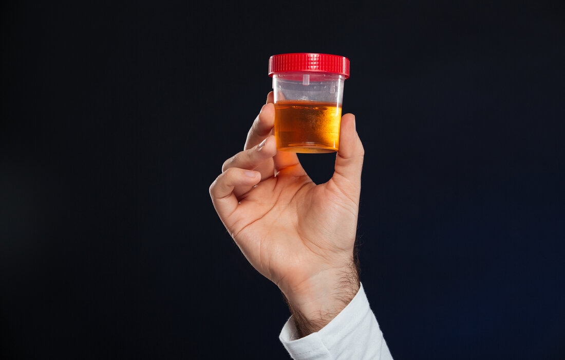 Urine Trouble : Causes, Symptômes et Consultations